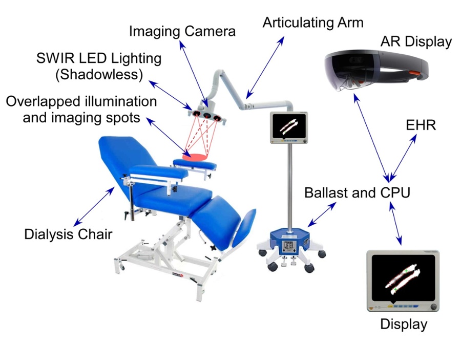 A Game-Changing Solution to Arterio-Venous Access Issues